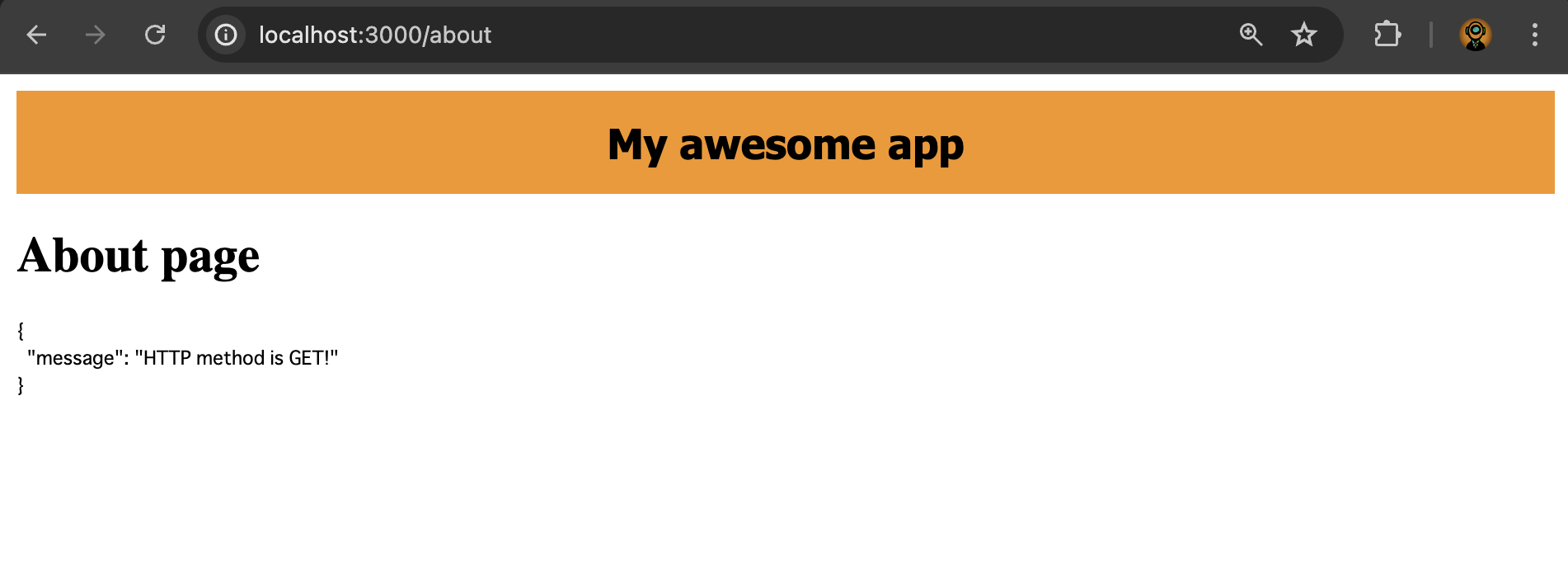 【Nuxt 3】基本機能をなんとなく理解する #JavaScript - Qiita