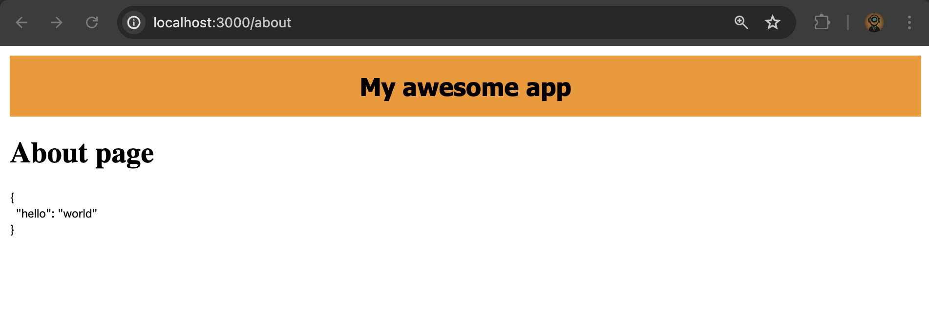 【Nuxt 3】基本機能をなんとなく理解する #JavaScript - Qiita