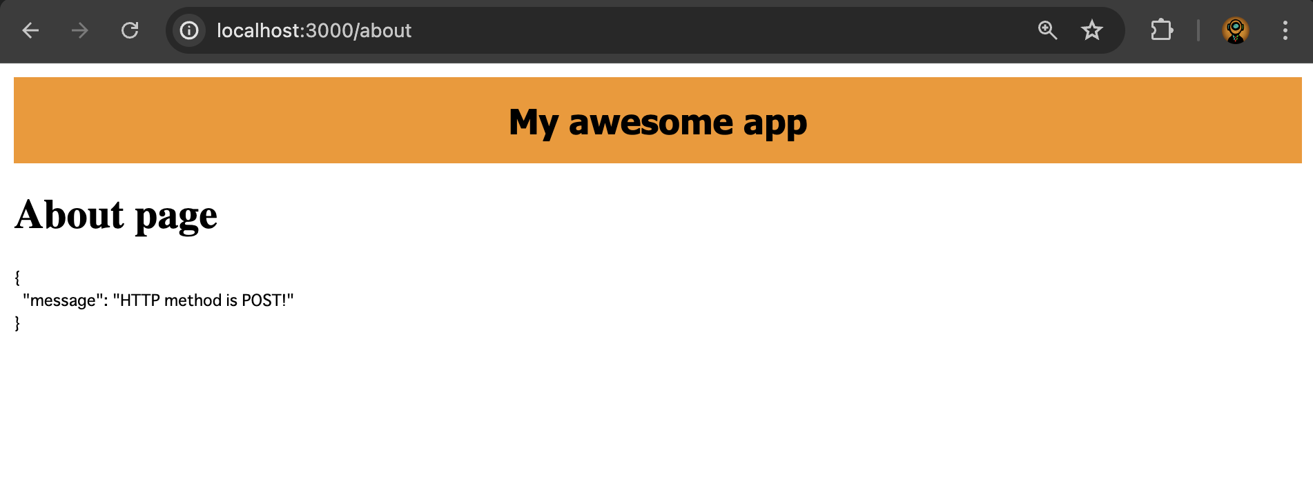 【Nuxt 3】基本機能をなんとなく理解する #JavaScript - Qiita