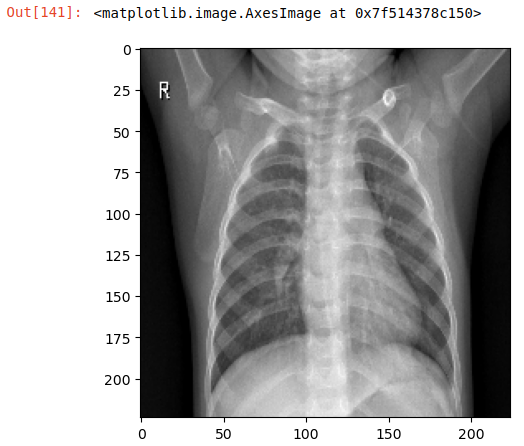 【機械学習】grad-CAMをpythonで実装し、予測の根拠を視覚化する。 #Python - Qiita