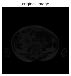 【Pytorch】UNetを実装する #Python - Qiita