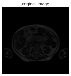 【Pytorch】3DのUNetを実装する #Python - Qiita