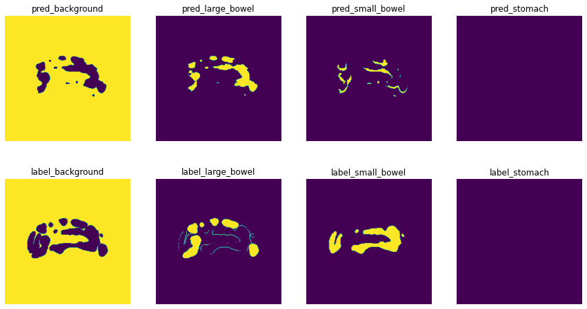 【Pytorch】3DのUNetを実装する #Python - Qiita