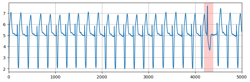 【時系列波形異常検知 part2】DAMPによる時系列ディスコードの探索 (Python実装例付) #時系列解析 - Qiita