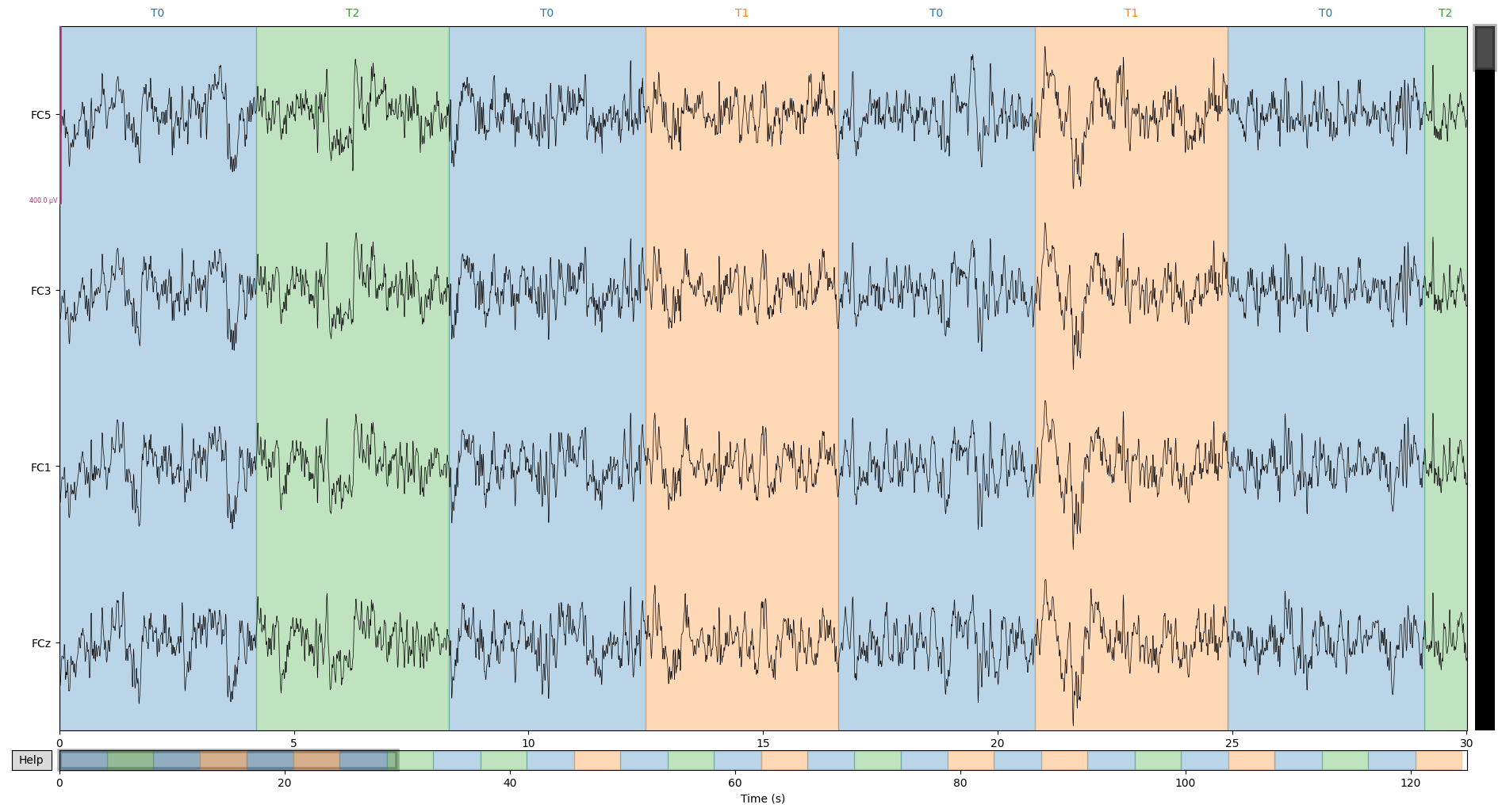 MNE-Python の使い方 運動想起の解析 #eeg - Qiita