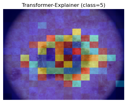 【Vit】判断根拠の可視化4選（Attention map / Grad-CAM） #Python - Qiita