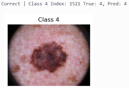 【Vit】判断根拠の可視化4選（Attention map / Grad-CAM） #Python - Qiita