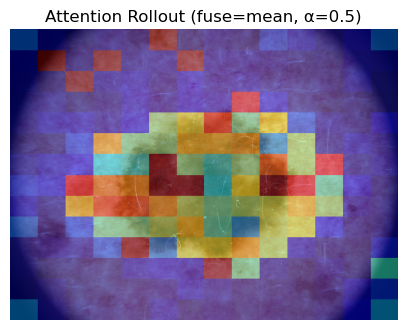 【Vit】判断根拠の可視化4選（Attention map / Grad-CAM） #Python - Qiita