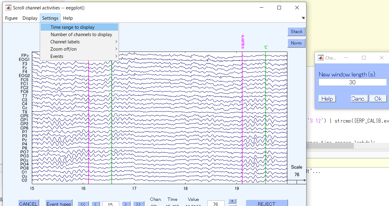 [EEGLAB 手順メモ part 1] Preprocessing data in EEGLAB #neuroscience - Qiita