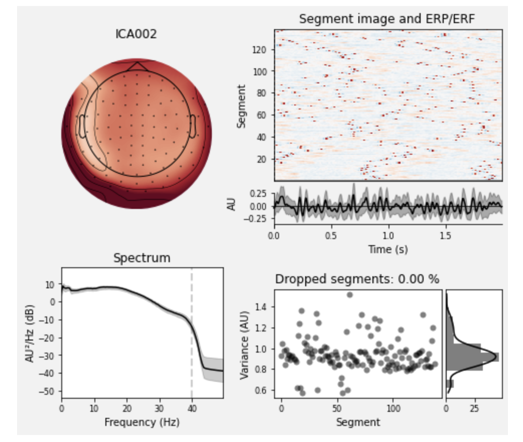 Pythonで脳波解析：Python MNEのチュートリアル #eeg - Qiita