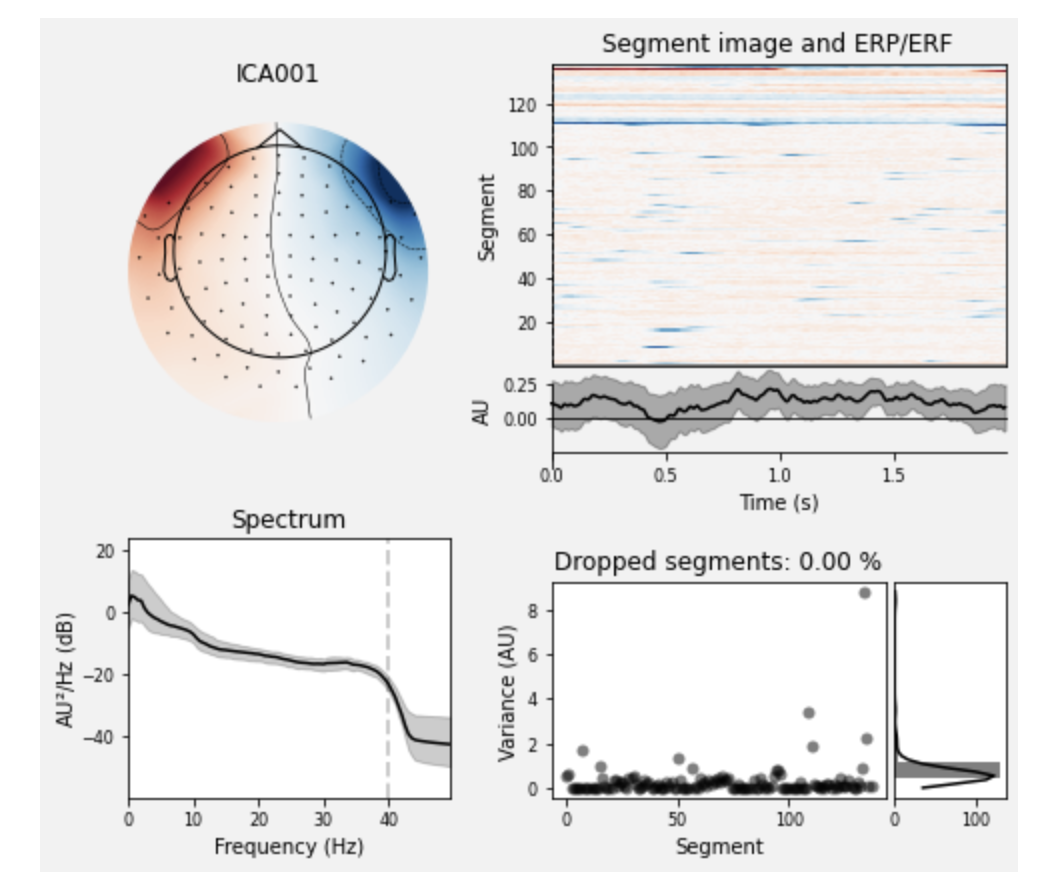 Pythonで脳波解析：Python MNEのチュートリアル #eeg - Qiita