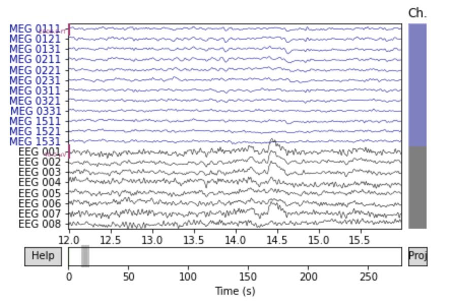 Pythonで脳波解析：Python MNEのチュートリアル #eeg - Qiita