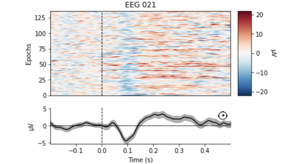 Pythonで脳波解析：Python MNEのチュートリアル #eeg - Qiita
