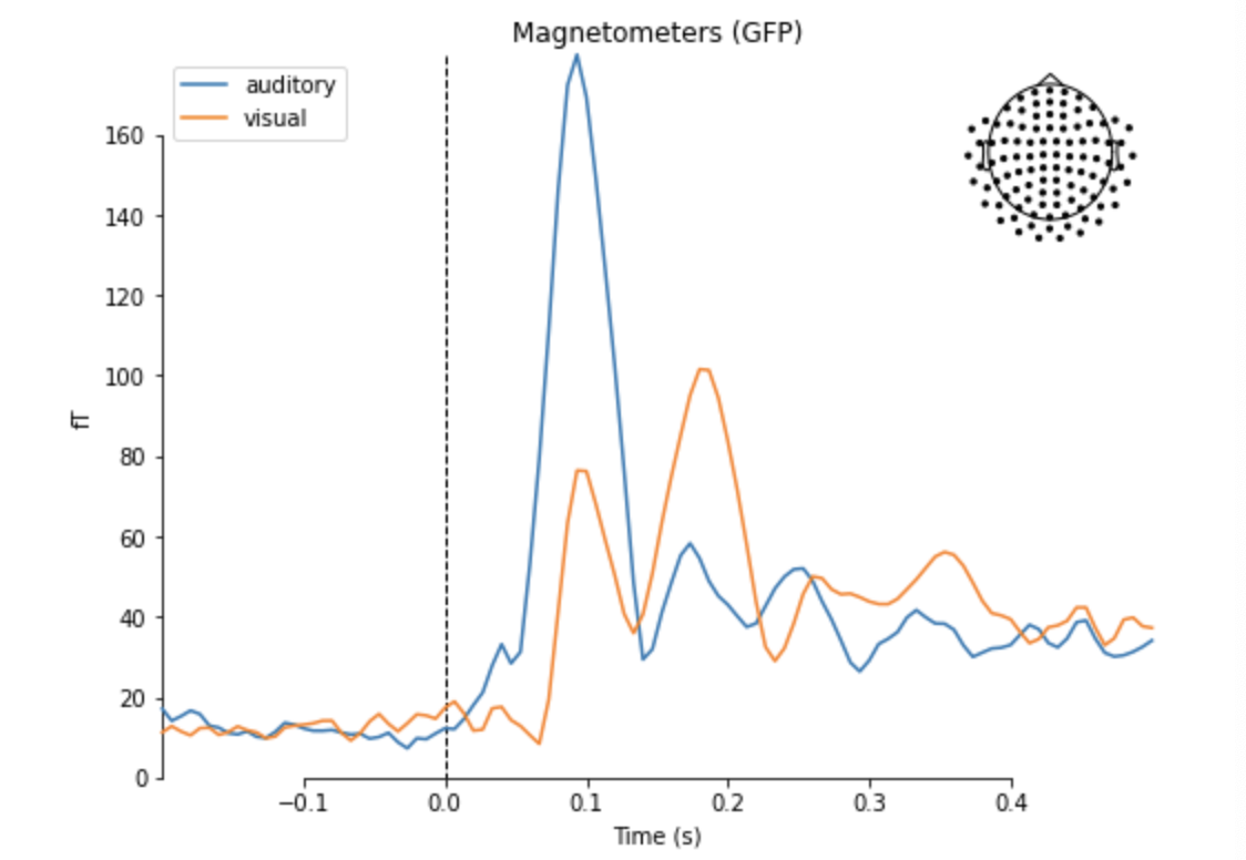Pythonで脳波解析：Python MNEのチュートリアル #eeg - Qiita