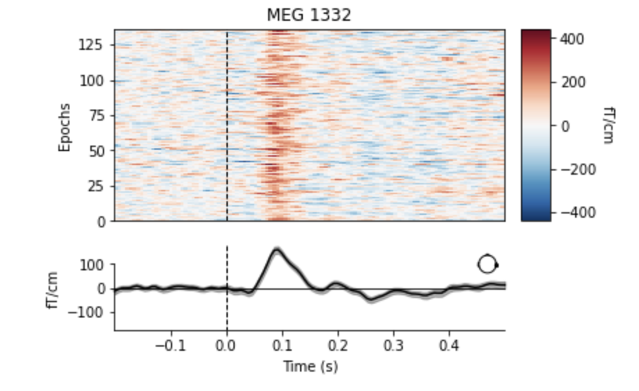 Pythonで脳波解析：Python MNEのチュートリアル #eeg - Qiita