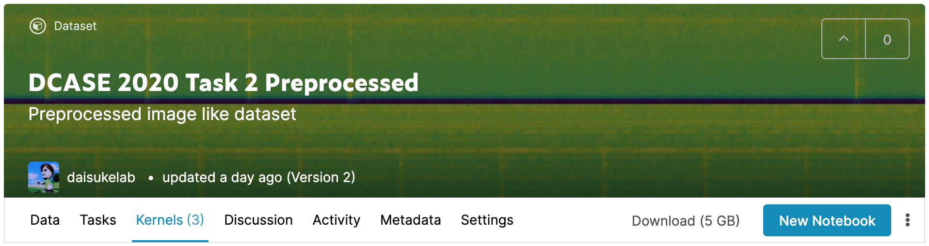 機械音の異常検知チャレンジ DCASE 2020 Task 2 #機械学習 - Qiita